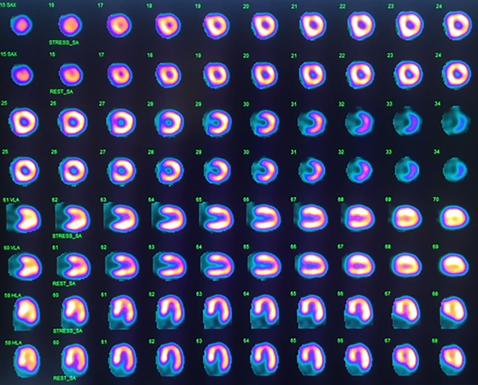 Foothill Cardiology Home